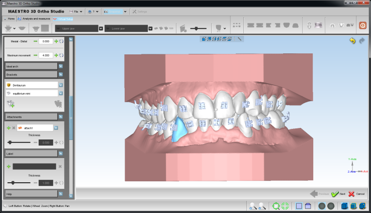 File:Ortho.studio.virtual.setup.brackets3.png - Maestro3D